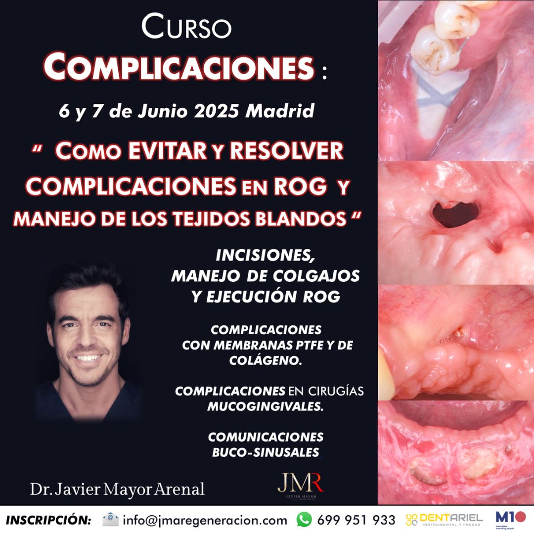 Curso de Complicaciones en ROG 2025 | Dr. Javier Mayor Arenal